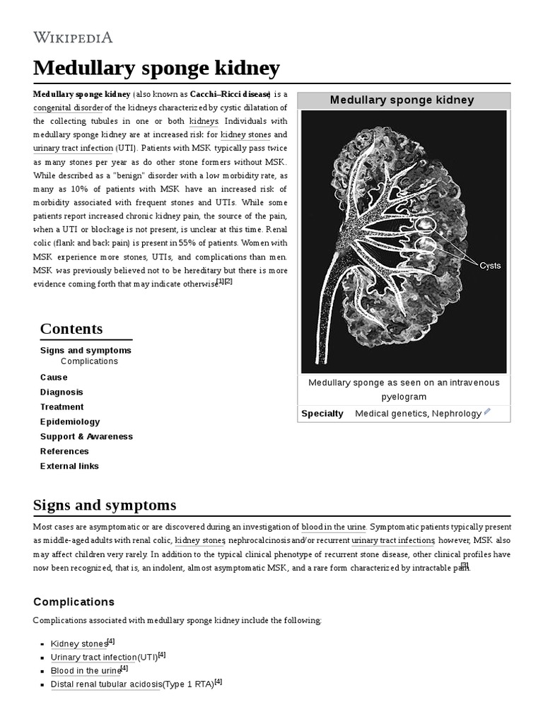 Medullary Sponge Kidney | PDF | Medical Specialties | Urology