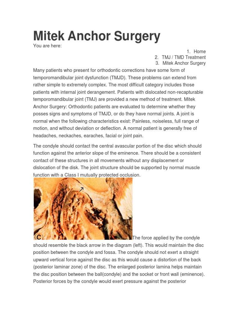 Mitek Anchor Surgery | PDF | Medical Specialties | Clinical Medicine