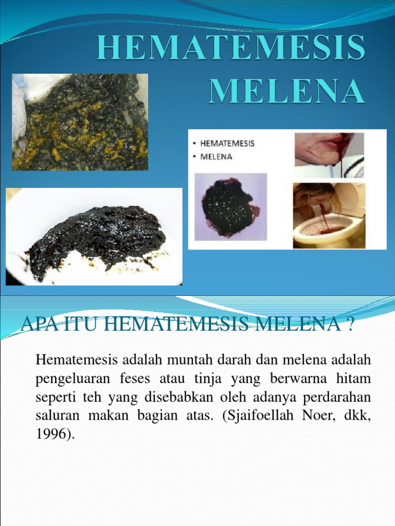 Hematemesis Melena | PDF