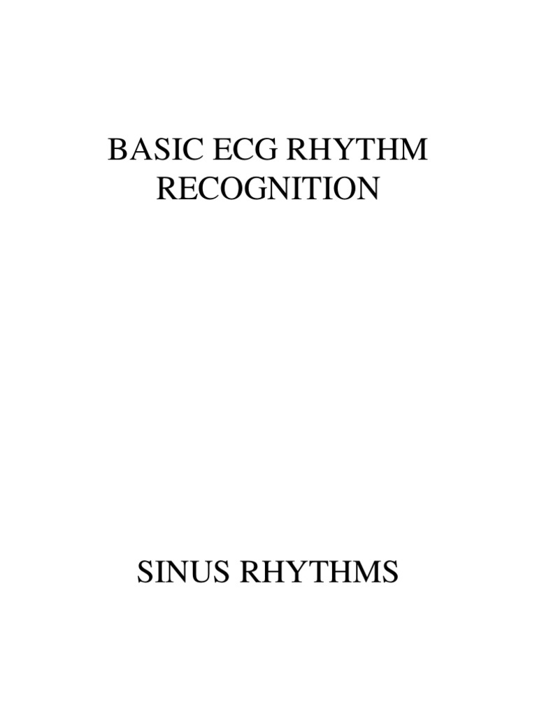 Ecg Rhythm Recognition | PDF