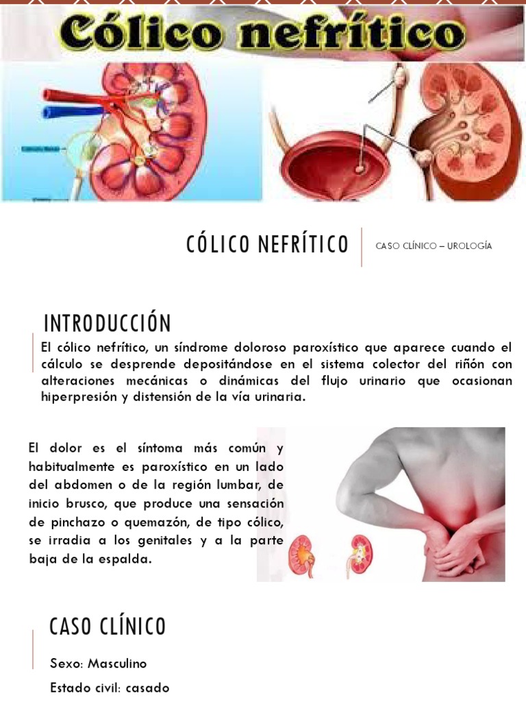 Colico Nefritico | PDF | Droga anti-inflamatoria libre de esteroides ...