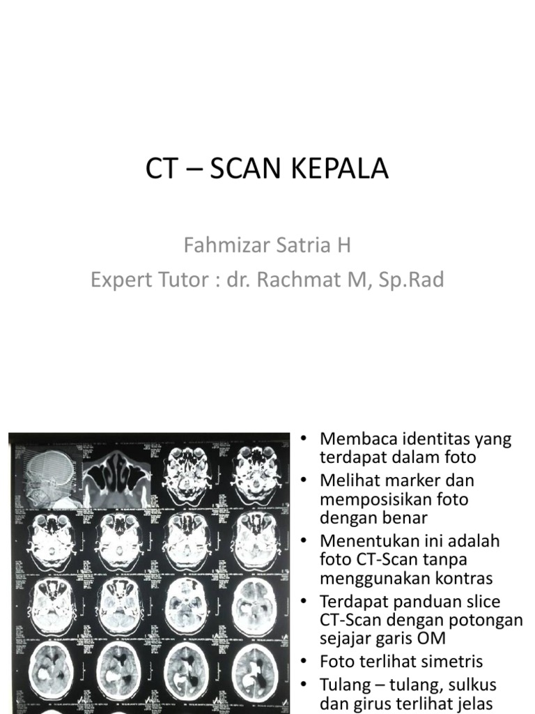 CT - Scan Kepala | PDF