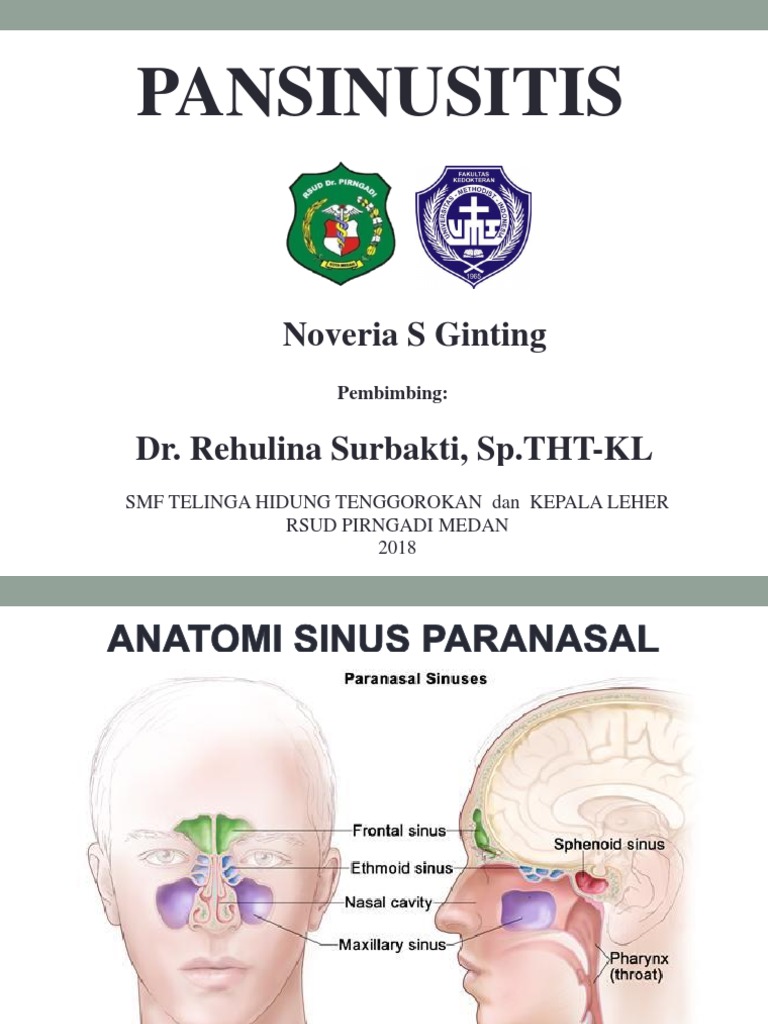 Pansinusitis | PDF