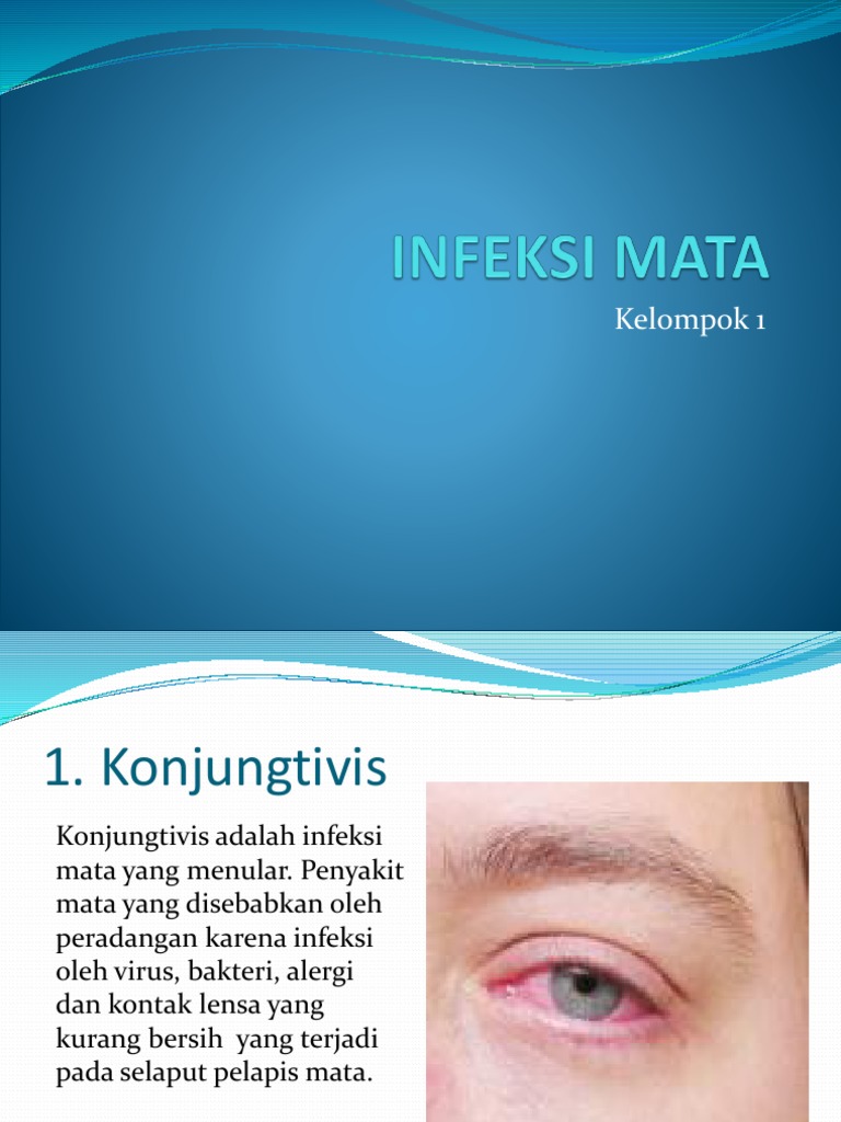 Infeksi Mata | PDF