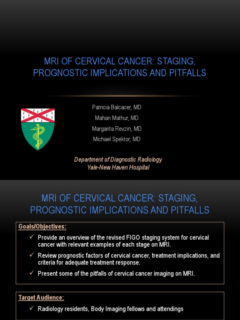 Mri of Cervical Cancer: Staging, Prognostic Implications and Pitfalls ...