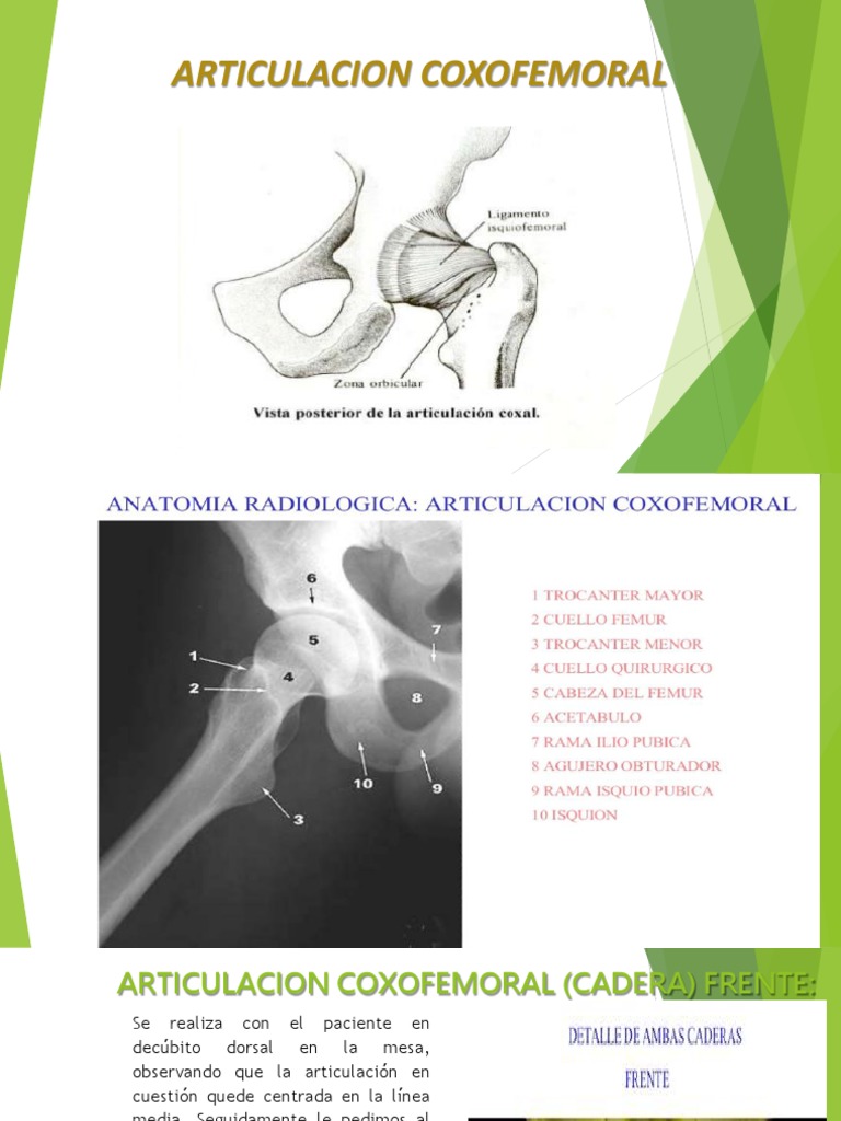 Articulacion Coxofemoral | PDF