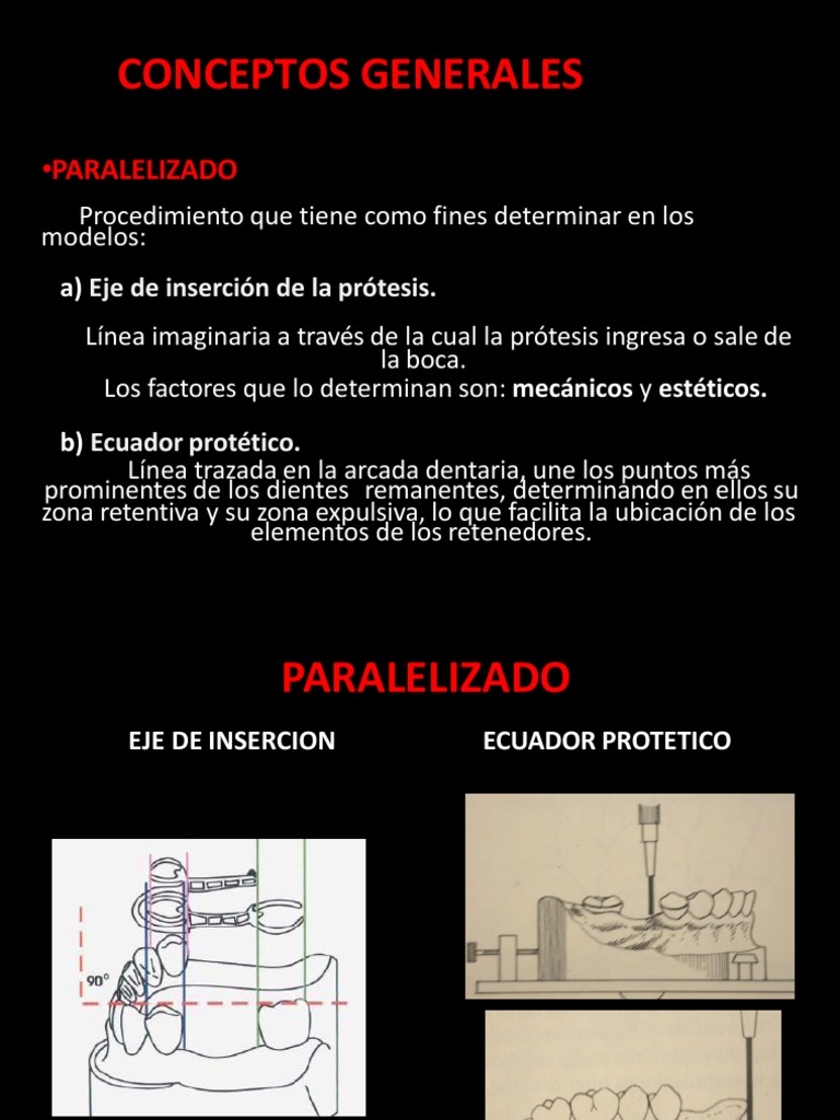Partes y Uso del Paralelígrafo Dental | PDF | Dentadura postiza ...