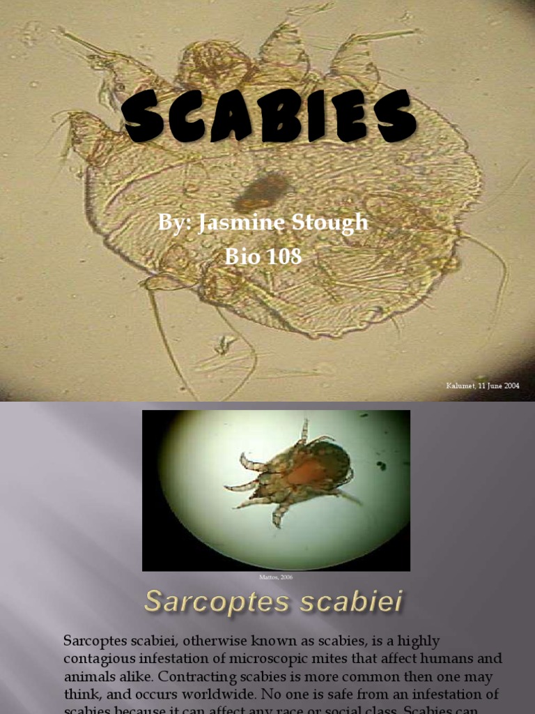 Scabies: History, Spread, and Treatment | PDF | Diseases And Disorders ...