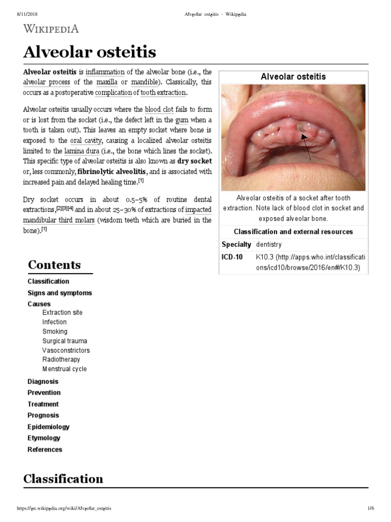 Alveolar Osteitis - Wikipedia | PDF | Dentistry | Dentistry Branches