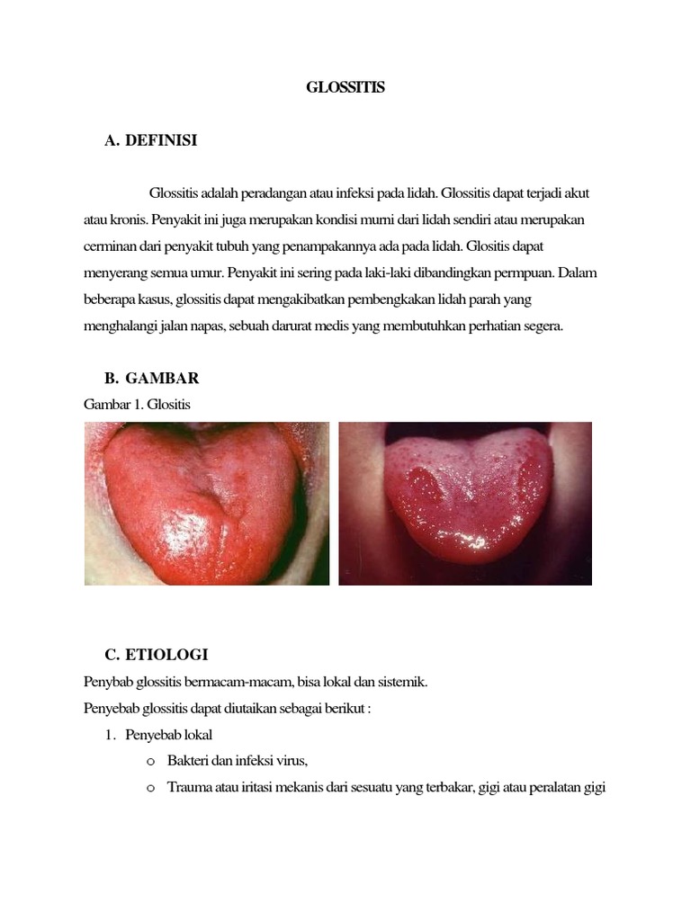 Penyebab dan Pengobatan Glossitis | PDF