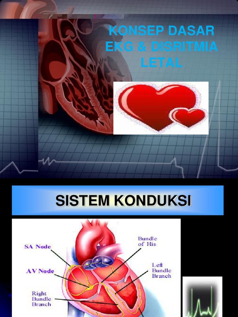 Konsep Dasar Ekg & Aritmia Letal | PDF