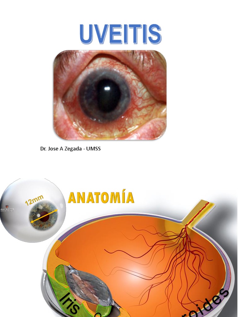 Uveitis | PDF | Enfermedades y trastornos | Inmunología