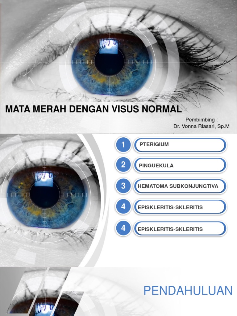 Eye Scanning Ophthalmology PowerPoint Template | PDF