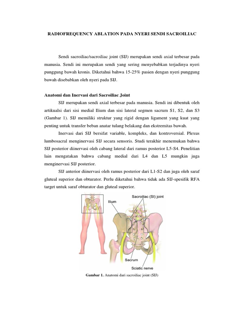 Radiofrequency Ablation Pada Nyeri Sendi Sacroiliac | PDF | Sains ...