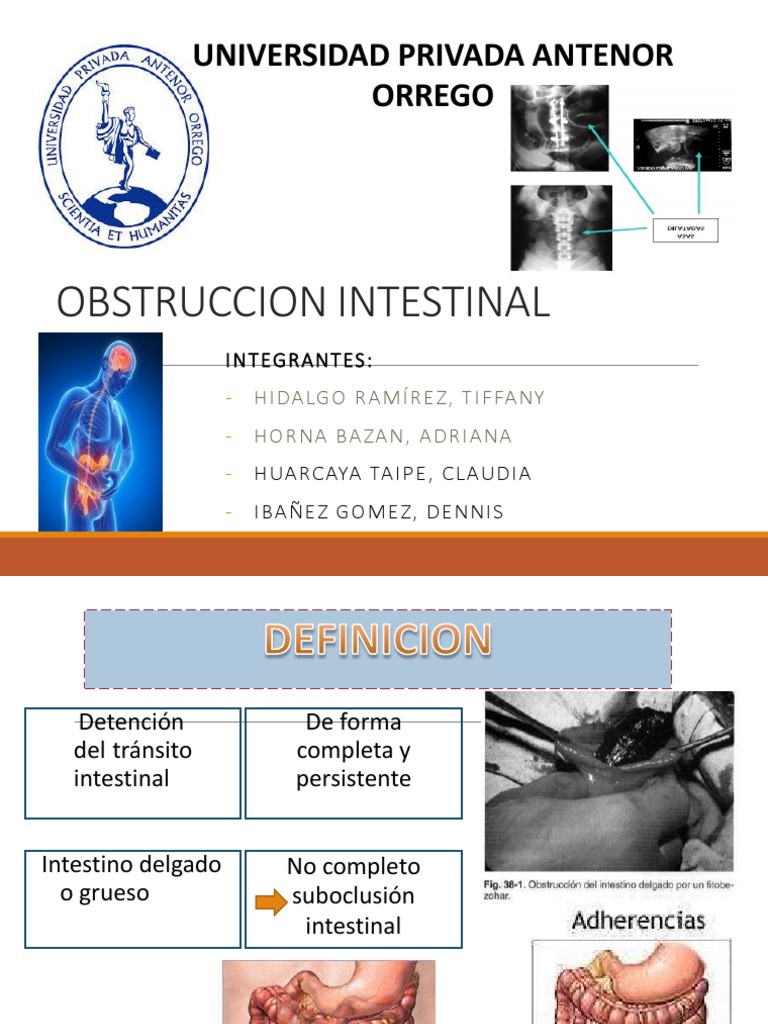 Obstruccion Intestinal Grupo 6 | PDF | Abdomen | Gastroenterología