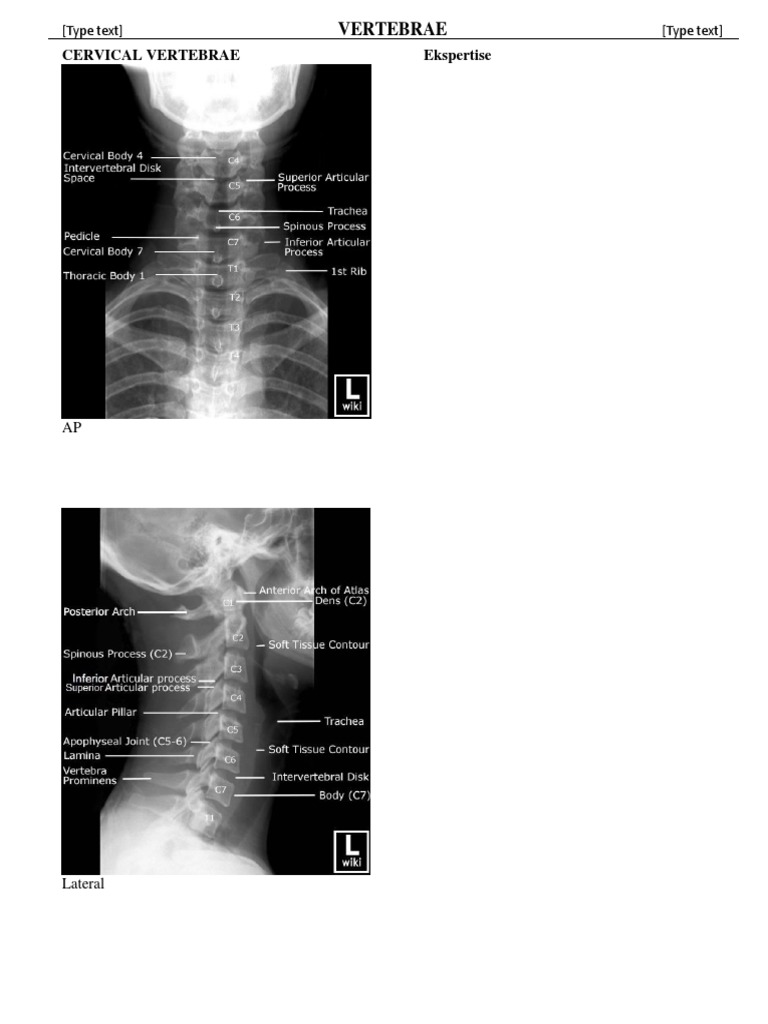 Radiologi Vertebrae | PDF