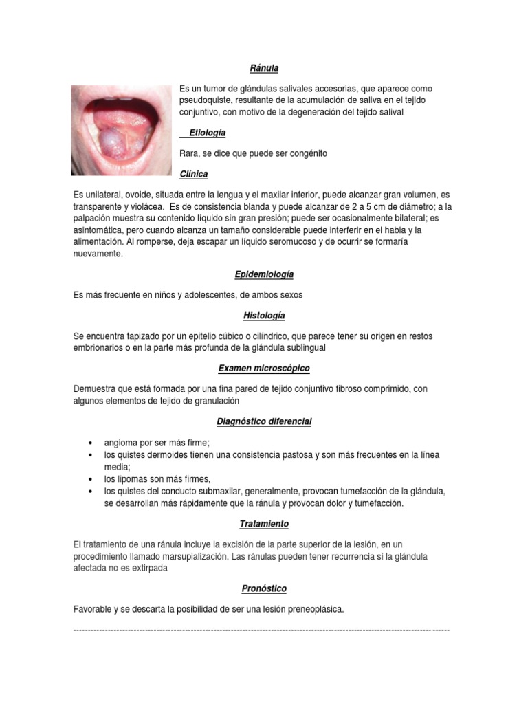 Ránula y Mucocele | PDF | Medicina | Medicina CLINICA
