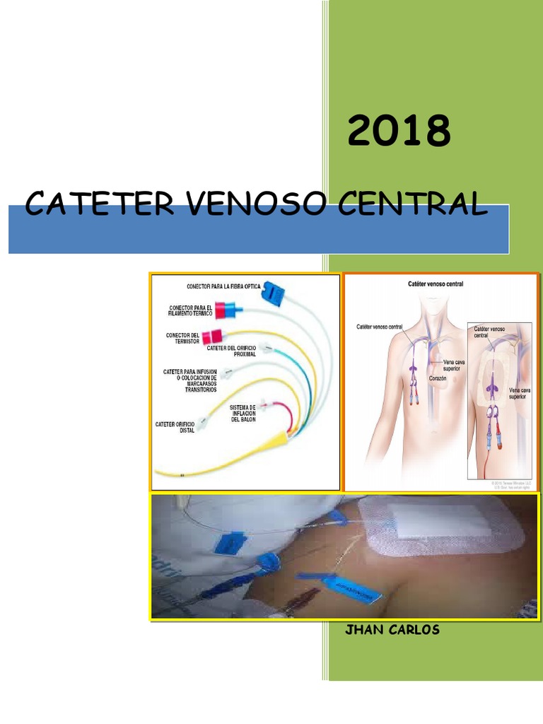 Tipos y Manejo del Catéter Venoso Central | PDF | Terapia intravenosa ...
