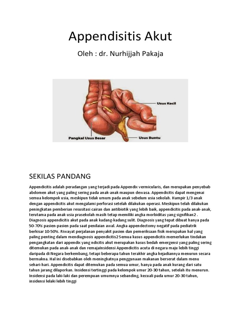 Appendisitis Akut Overview | PDF