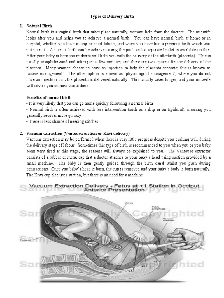 Types of Delivery Birth | PDF | Childbirth | Midwifery