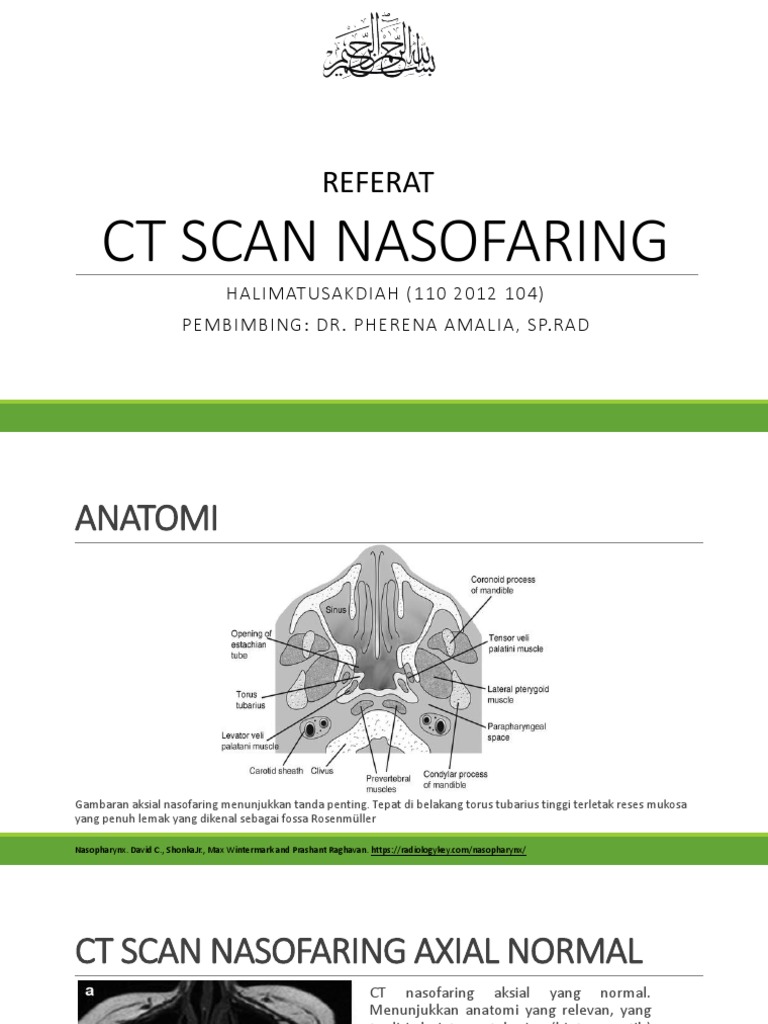 CT Scan Nasofaring | PDF