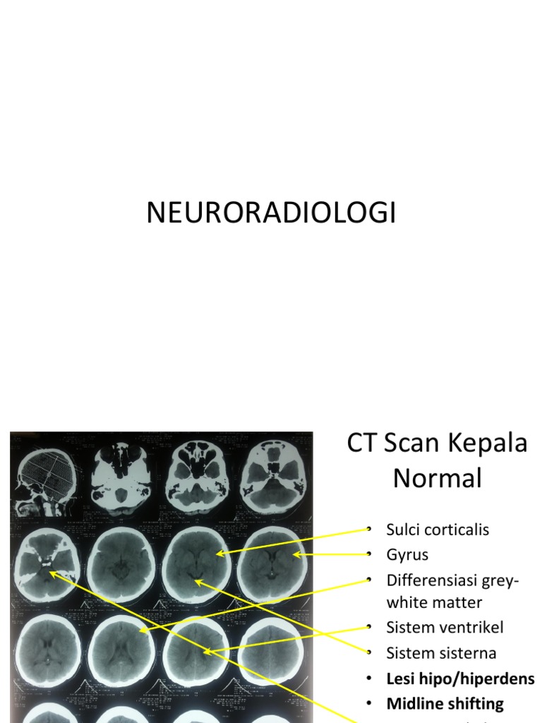 Radiologi Gambar Dan Keterangan | PDF
