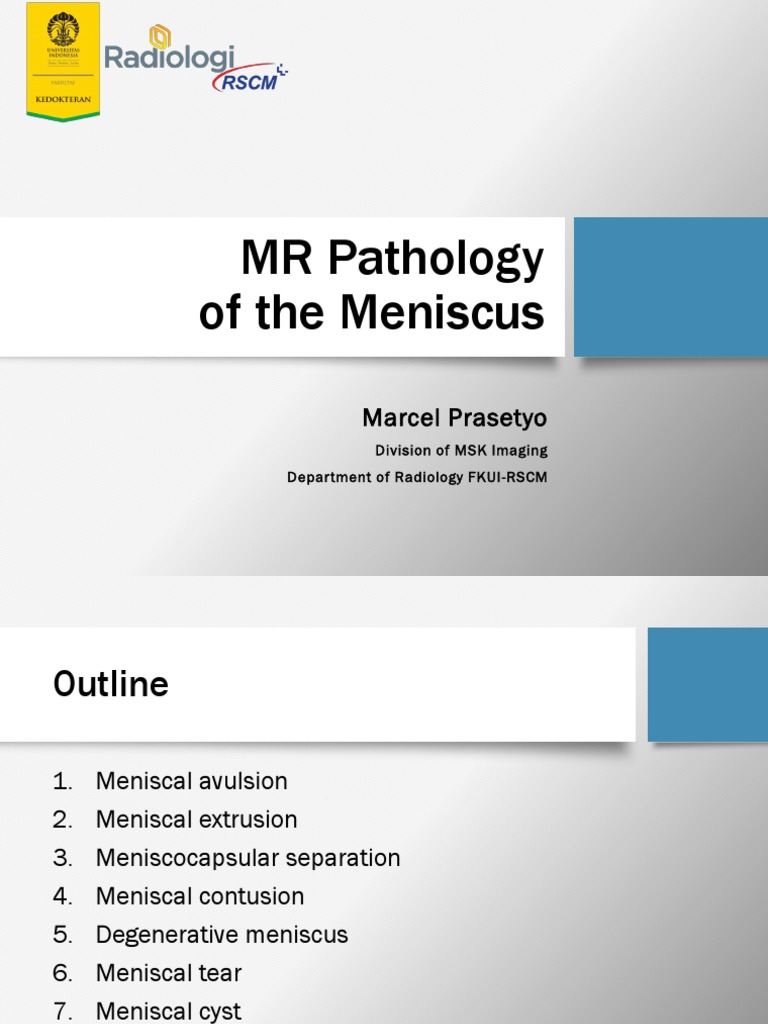 Ileus Obstruktif Ec CA Colon | PDF | Anatomical Terms Of Location | Joints