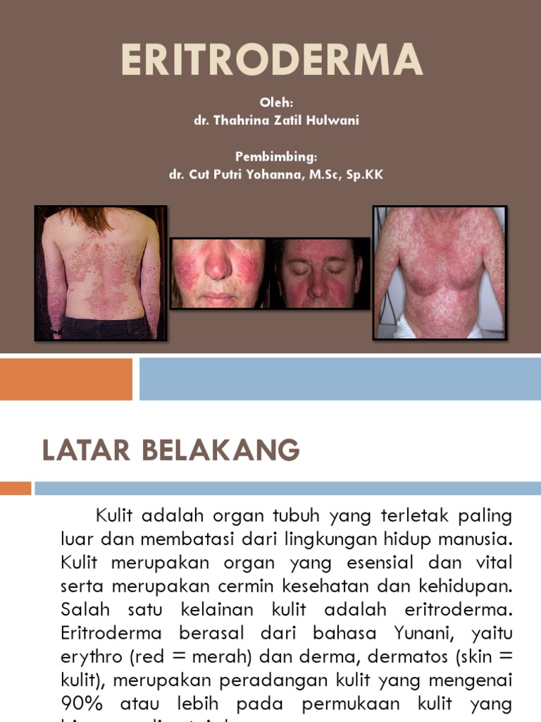 ERITRODERMA | PDF