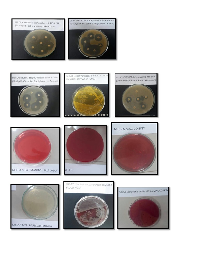 Uji Sensitivitas Antibiotik Fix | PDF