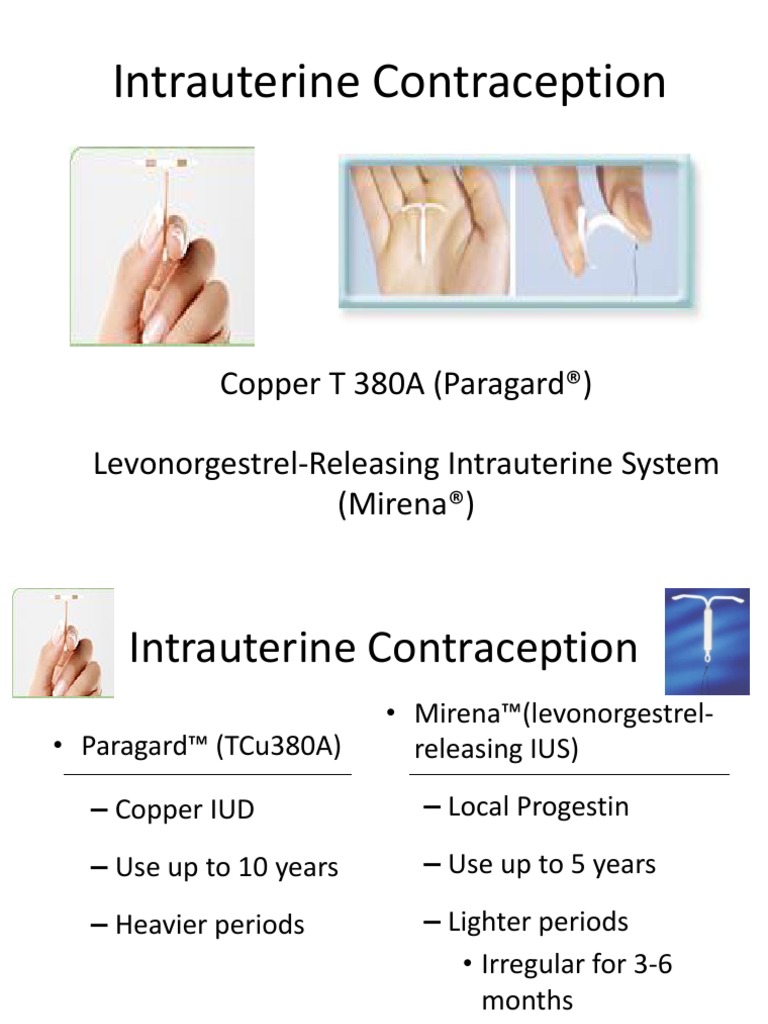 Intrauterine Contraception Copper T 380a Paragard Levonorgestrel