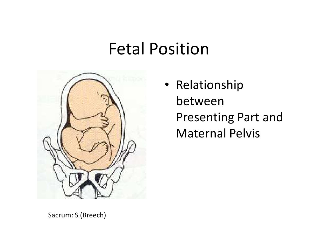 Fetal Positions | PDF