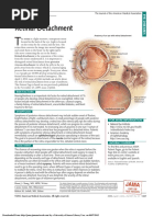 GLAUCOMA Revised Concept Map | PDF | Glaucoma | Human Eye