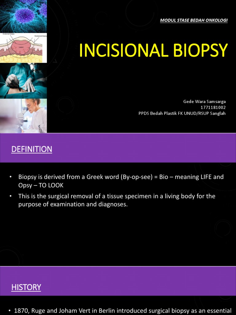 Incisional Biopsy: Modul Stase Bedah Onkologi | PDF | Biopsy | Diseases ...