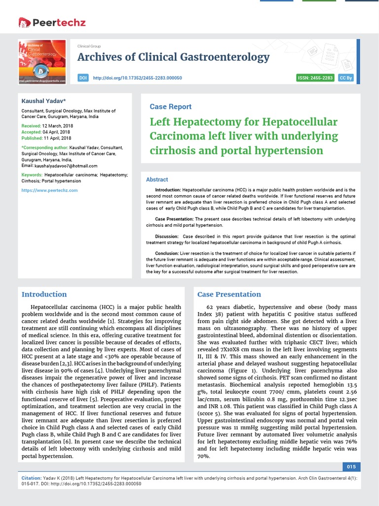 Left Hepatectomy For Hepatocellular Carcinoma Left Liver With ...