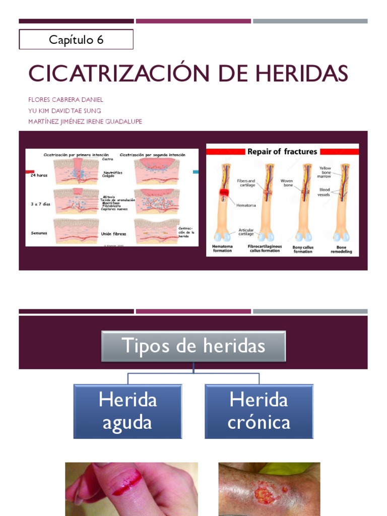Cicatrización de Heridas | Cicatrización de la herida | Colágeno