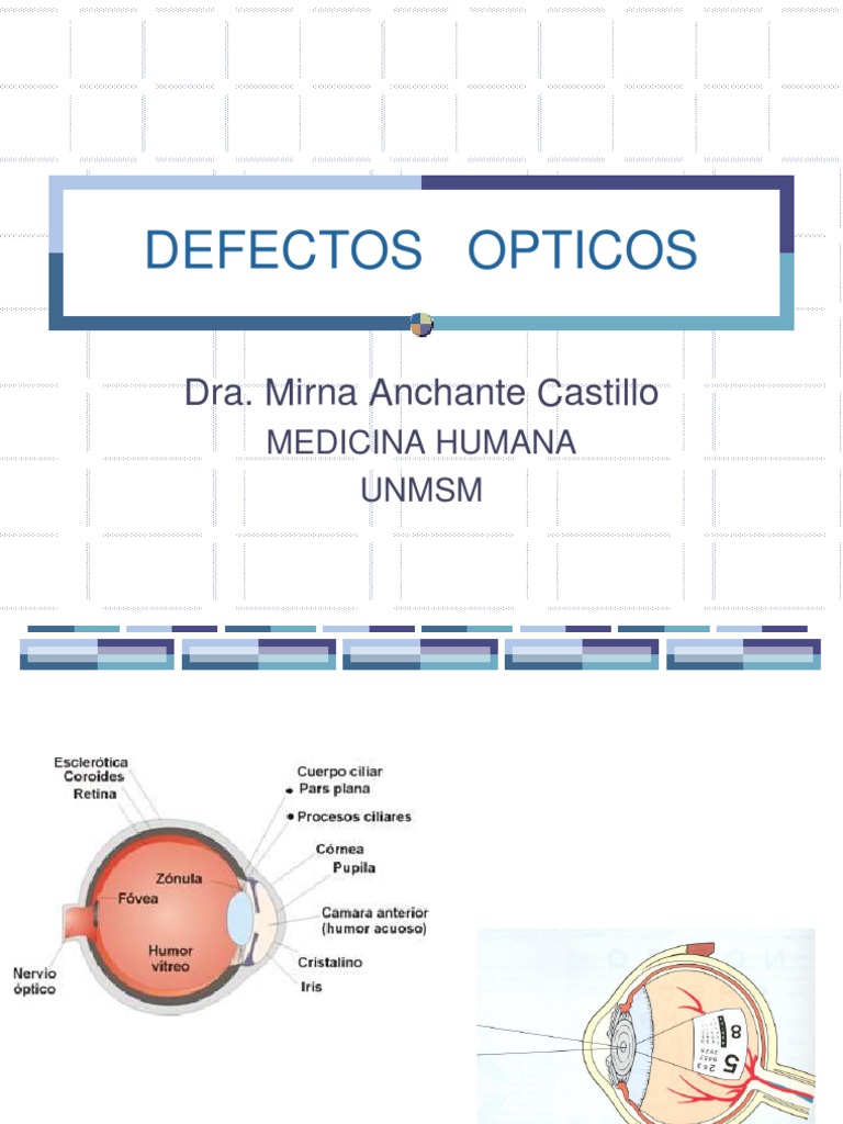 DEFECTOS OPTICOS | Ojo humano | Óptica