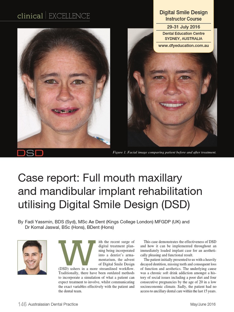 Clin DSD | PDF | Dental Implant | Dentistry