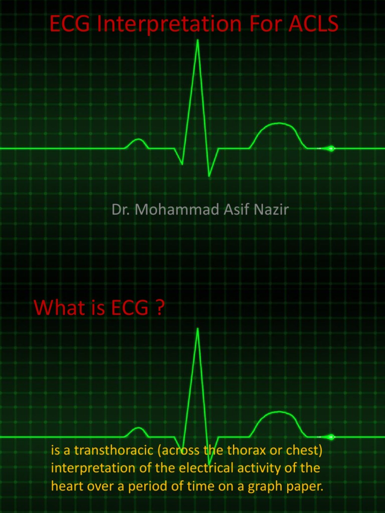 ECG Interpretation For ACLS | PDF | Electrocardiography | Cardiac ...