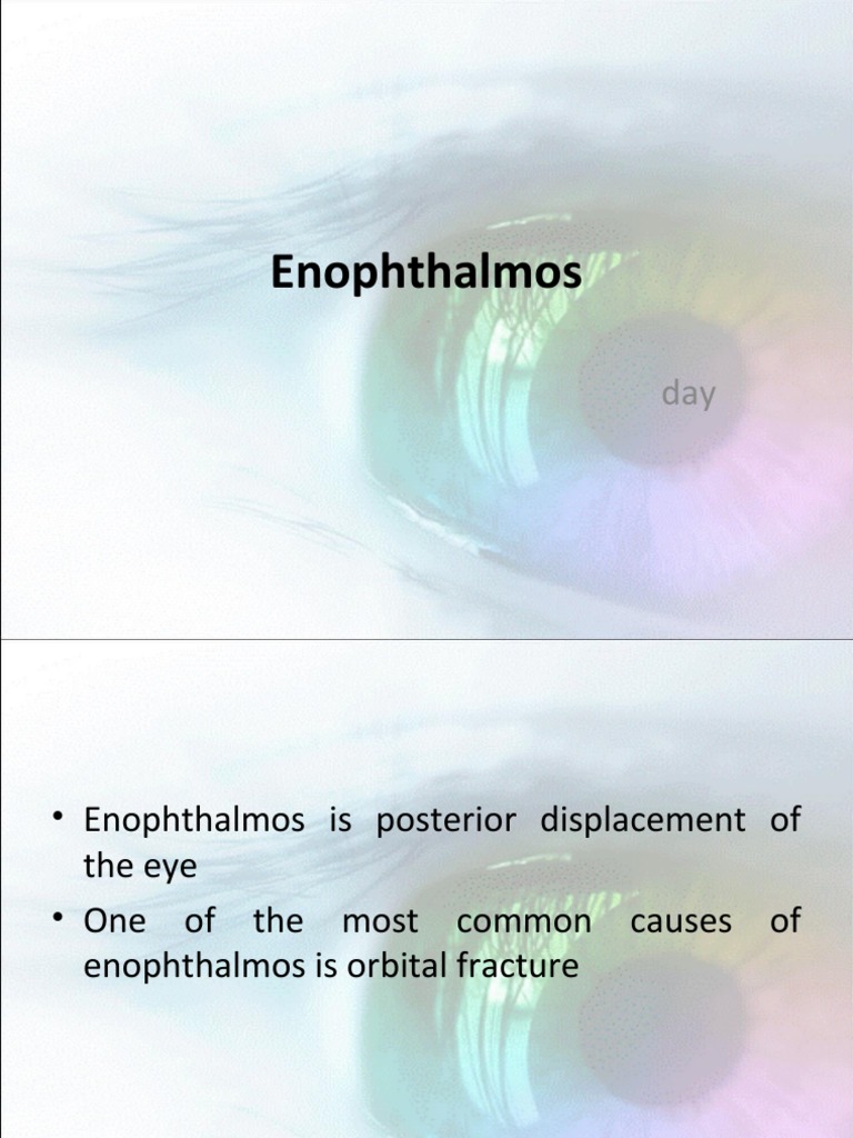 Enophthalmos: Causes and Treatments | PDF | Science & Mathematics