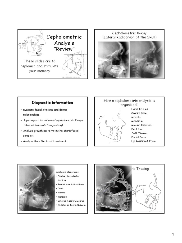 Ceph Analysis Slides | PDF | Face | Dentistry