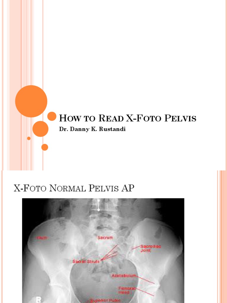 Cara Baca Rontgen Foto Pelvic | PDF