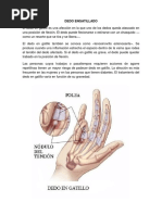 Cómo entablillar un dedo índice correctamente | PDF