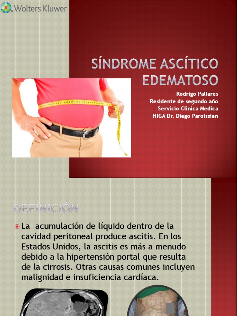 Síndrome Ascítico Edematoso Rodri | PDF | Cirrose | Sódio