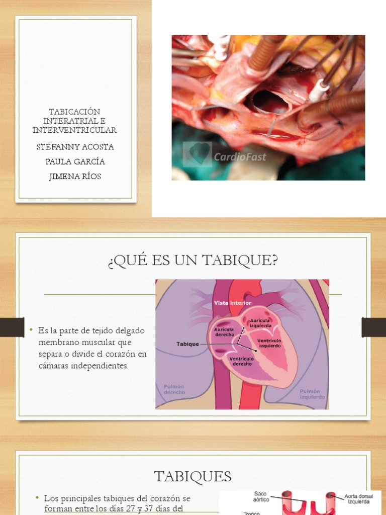 Tabique Inter y Ventricular | PDF | Ventrículo (corazón) | Corazón
