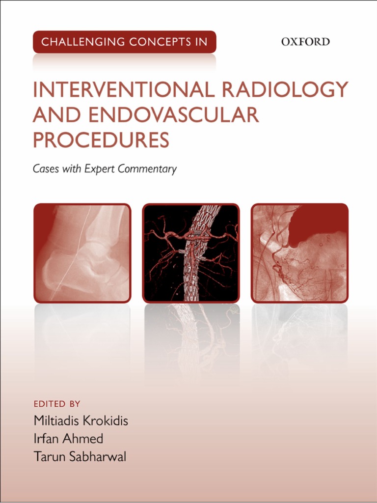 Challenging Concepts in INTERVENTIONAL RADIOLOGY 1st Edition PDF | PDF ...