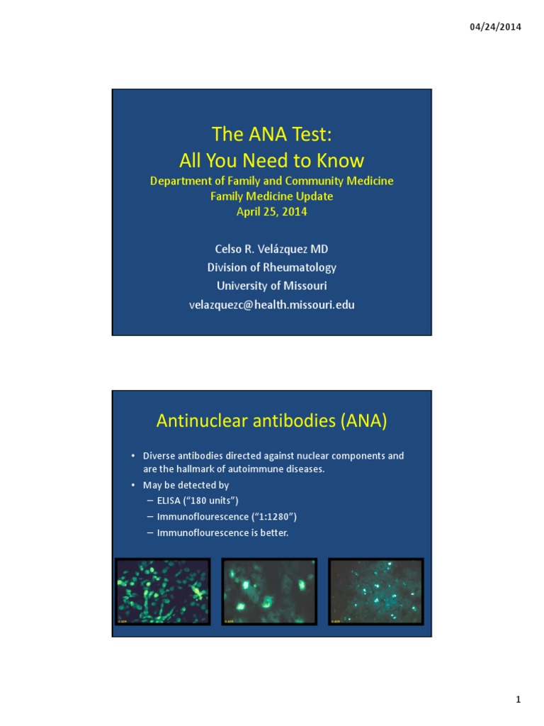 The ANA Test: All You Need To Know | PDF | Systemic Lupus Erythematosus ...