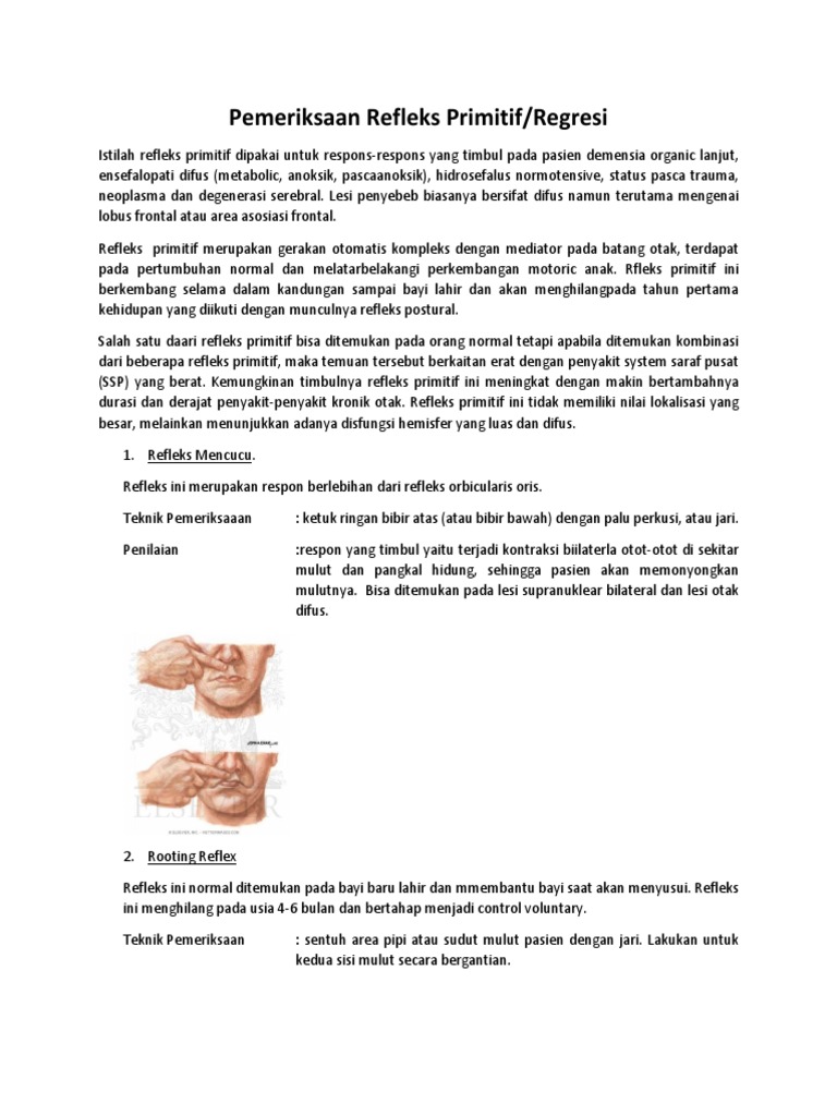 Pemeriksaan Refleks Primitif-TUGAS | PDF