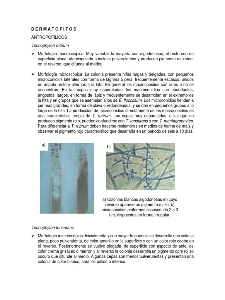 Atlas de dermatofitos | Hongo | Bienestar
