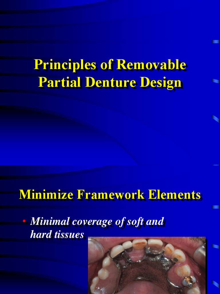 Principle Partial Dent Design | PDF | Dentures | Mouth