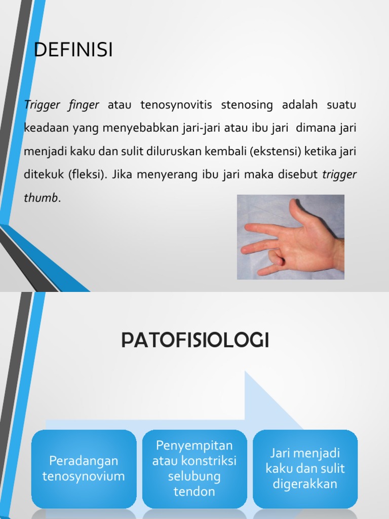 Triger Finger | PDF